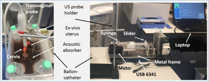 Uterine model advances ultrasound technology – Physics World