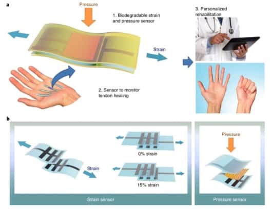Biodegradable pressure sensor eliminates the need for second surgery ...