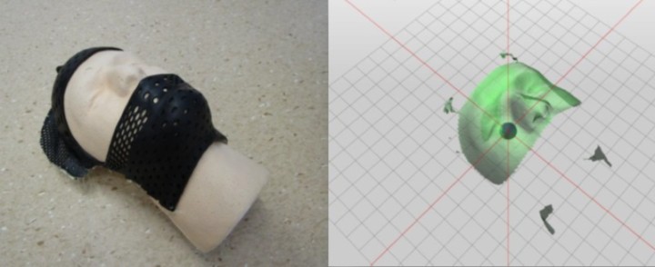 Surface guidance: a new tool for radiotherapy – Physics World