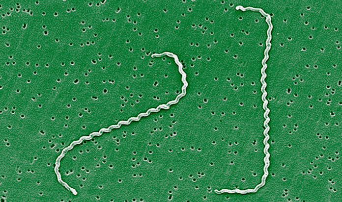 Bacterial swimming in complex fluids better understood with new ...