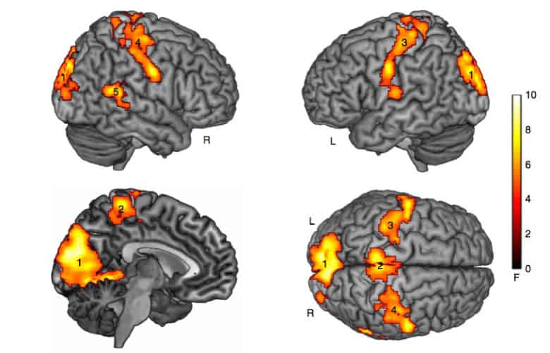 Brain modulation improves twilight vision – Physics World