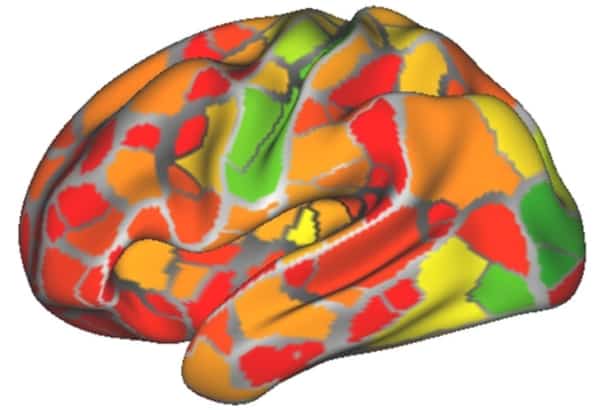 Functional MRI scans could help identify brain disorders – Physics World