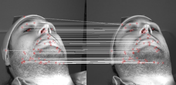Markerless tracking monitors head motion in brain scans – Physics World