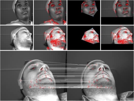 Markerless tracking monitors head motion in brain scans – Physics World