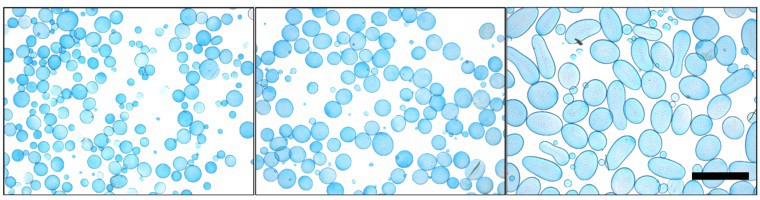 Encapsulated cells to regenerate intervertebral discs – Physics World