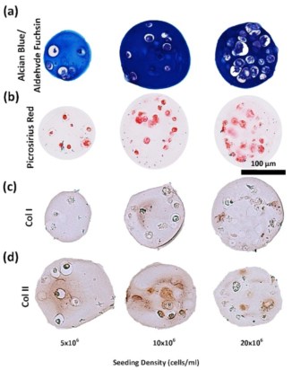 Encapsulated cells to regenerate intervertebral discs – Physics World
