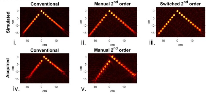 Beam's eye MRI could guide radiotherapy – Physics World
