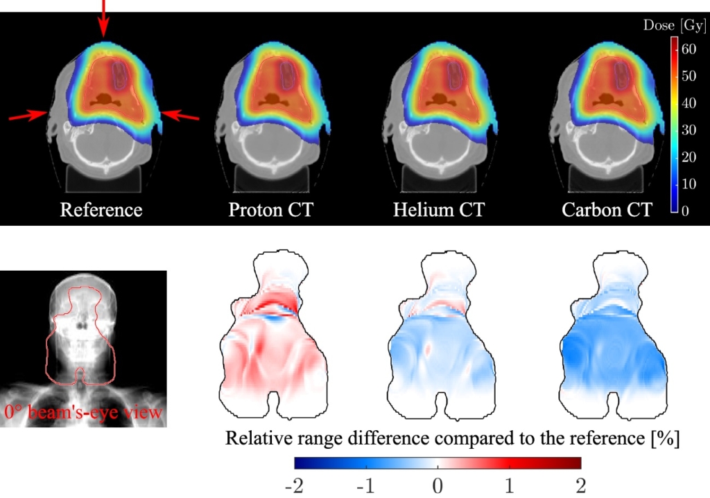 Ion-beam CT improves particle therapy planning – Physics World