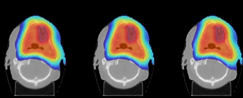 Ion-beam CT improves particle therapy planning – Physics World