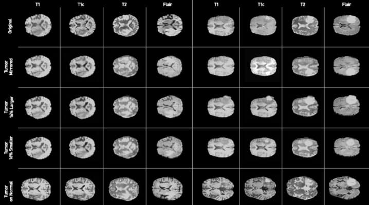 AI algorithm produces synthetic brain MR images – Physics World