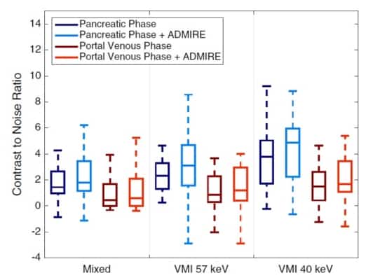 Split‐filter DECT improves tumour visibility for radiotherapy planning ...
