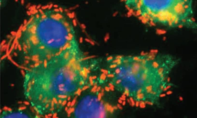 Light controls a ‘living biomaterial’ – Physics World