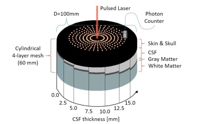 Non-invasive NIR imaging tracks brain shrinkage – Physics World