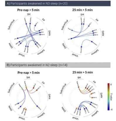 Simultaneous EEG and fMRI measure sleep 'inertia' – Physics World