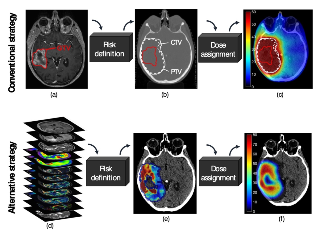 Multi-modality imaging predicts tumour recurrence – Physics World Multi-modality imaging predicts tumour recurrence – Physics World