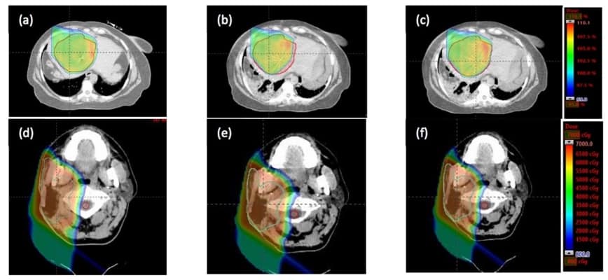 Mobile CT scanner lines up for adaptive proton therapy – Physics World