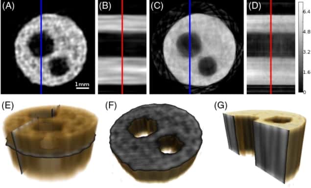 3D X-ray techniques can enhance medical imaging – Physics World