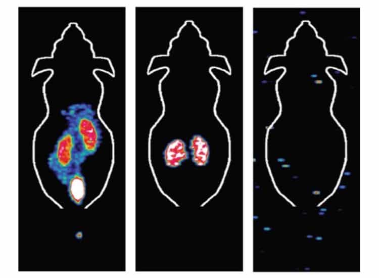 DNA origami heals kidneys – Physics World