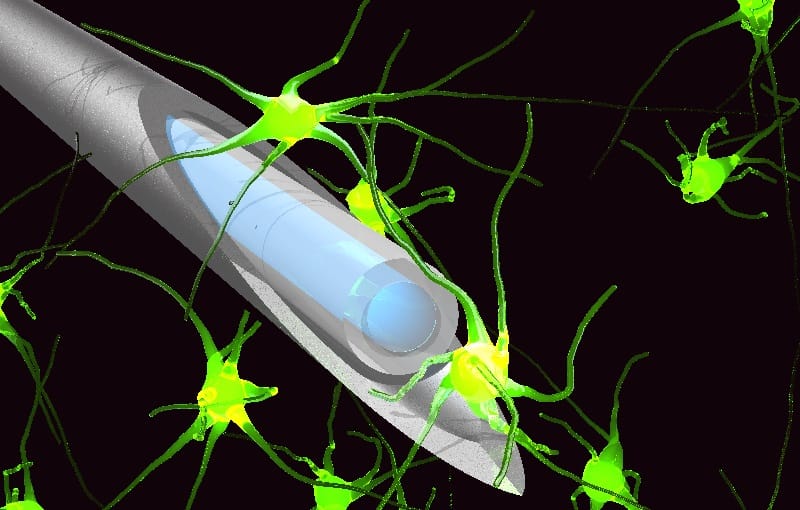 Fibre-based probe enables real-time deep-brain imaging – Physics World