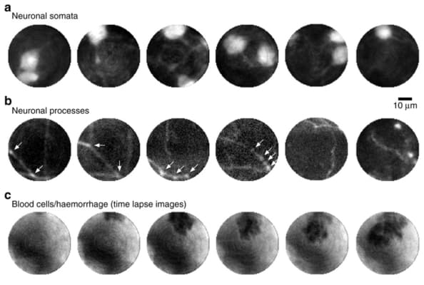 Fibre-based probe enables real-time deep-brain imaging – Physics World