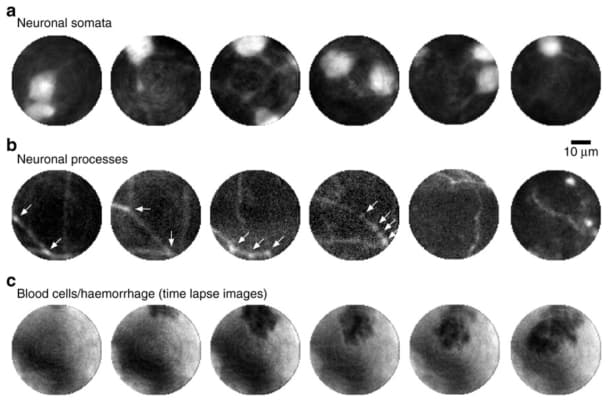 Fibre-based probe enables real-time deep-brain imaging – Physics World