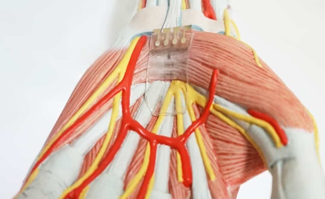 Synthetic synapse uses light to contract artificial muscle – Physics World