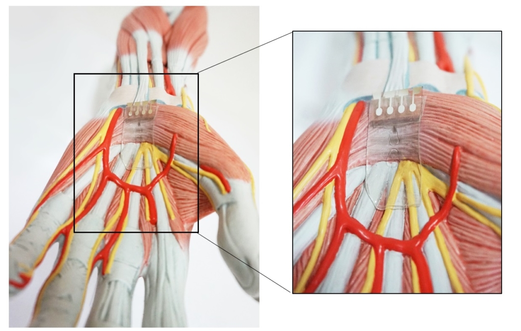 Synthetic synapse uses light to contract artificial muscle – Physics World