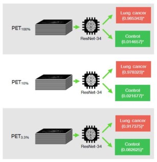Ultralow-dose FDG-PET gives boost to lung cancer screening – Physics World