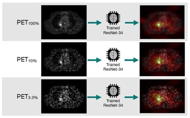 Ultralow-dose FDG-PET gives boost to lung cancer screening – Physics World