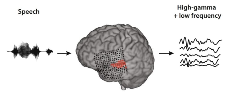 Thinking aloud: translating thoughts directly into speech – Physics World