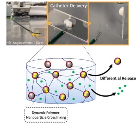 Injectable hydrogel lines up for multiple drug delivery – Physics World