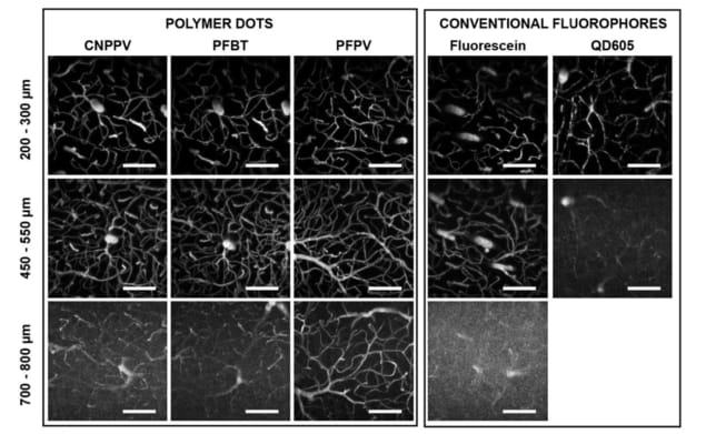 Polymer dots image deep into the brain – Physics World