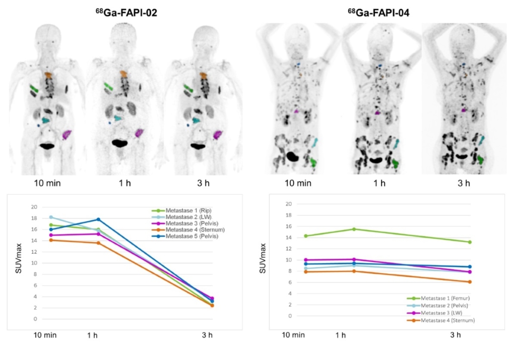 New PET tracers show immense promise in cancer imaging – Physics World