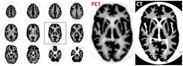 Whole-body PET for your pet – Physics World