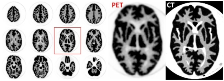 Whole-body PET for your pet – Physics World