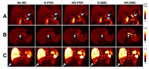 Motion correction enables quantitative PET scans – Physics World