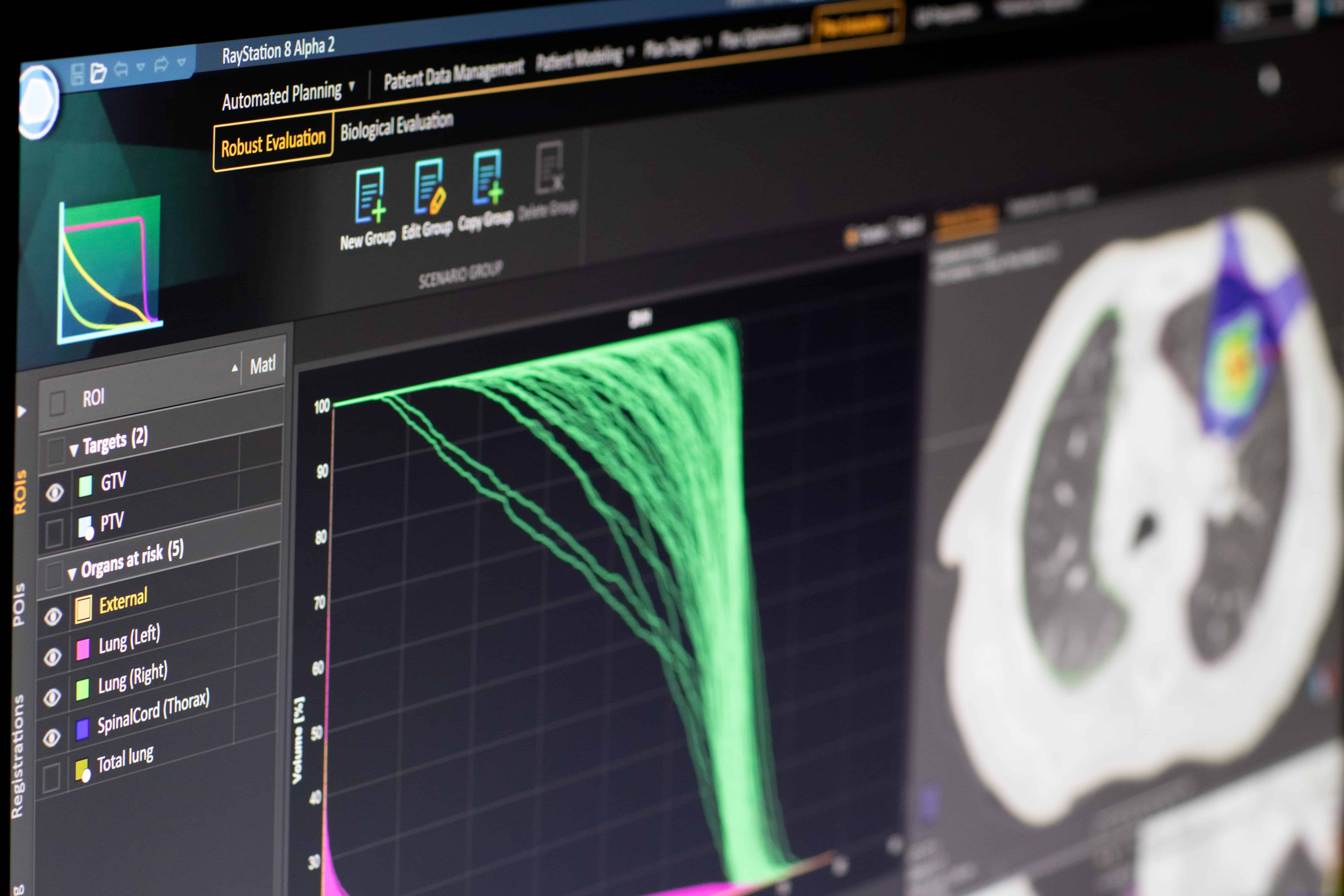 Machine learning ready to shine in radiation therapy – Physics World