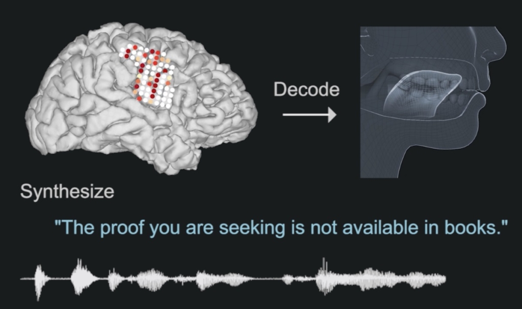 Decoder translates brain activity into speech – Physics World