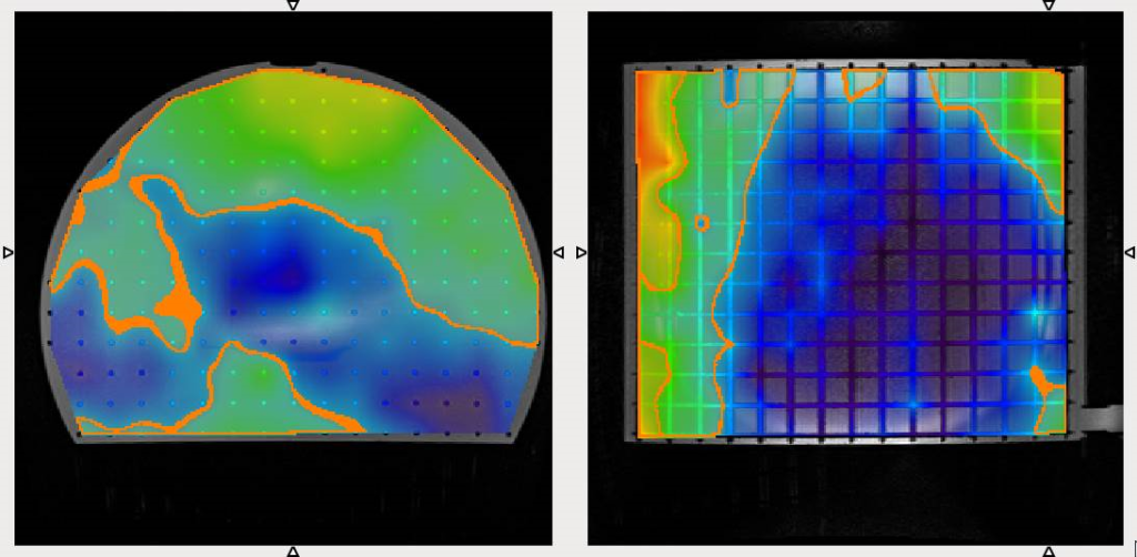 Getting to grips with MR image distortion – Physics World