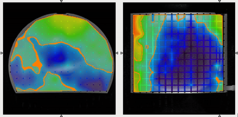 Getting to grips with MR image distortion – Physics World