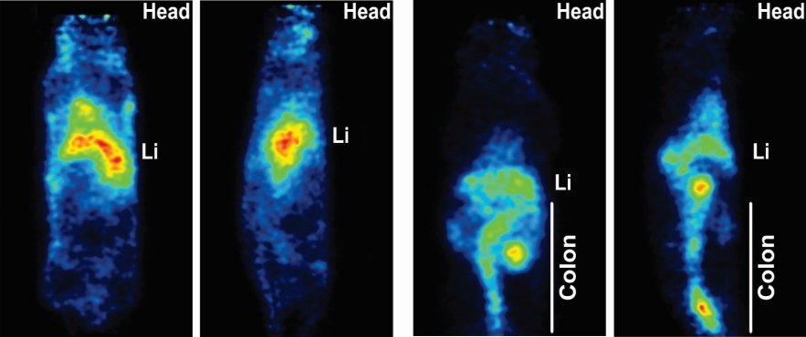 Immuno-PET could aid patients with inflammatory diseases – Physics World