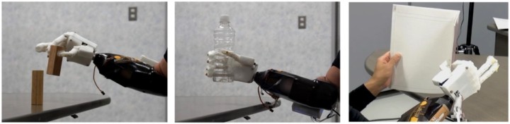 Prosthetic hand controls finger motion with high accuracy and minimal ...