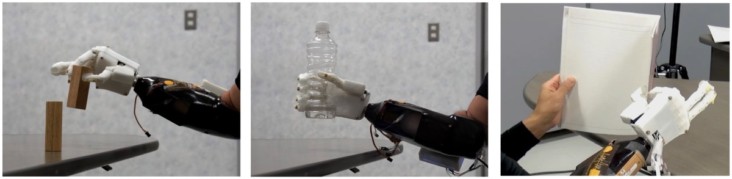 Prosthetic hand controls finger motion with high accuracy and minimal ...