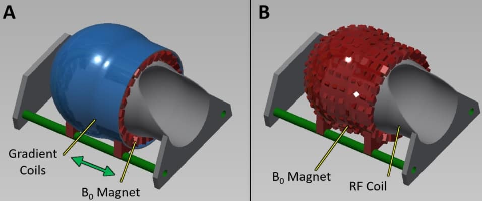 Portable brain MRI scanner increases access to neuroimaging – Physics World