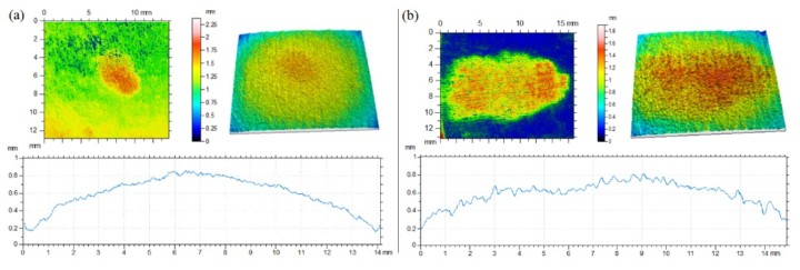 Intelligent 3D scanner helps diagnose skin cancers – Physics World