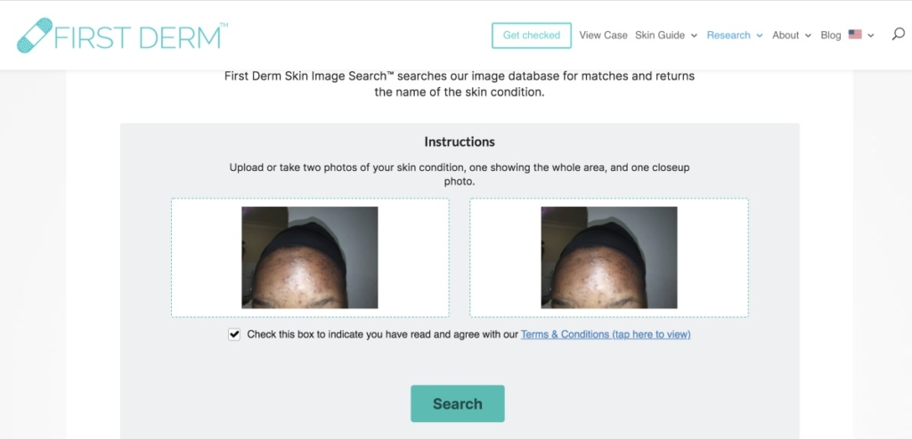 AI dermatology tool needs more diverse skin types in its training ...