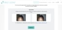 AI dermatology tool needs more diverse skin types in its training ...