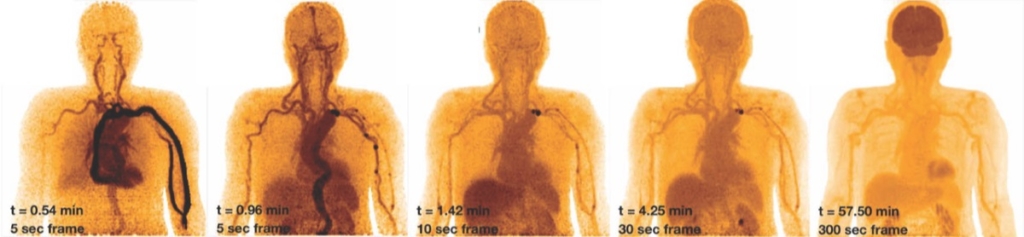 PennPET Explorer acquires first human images – Physics World