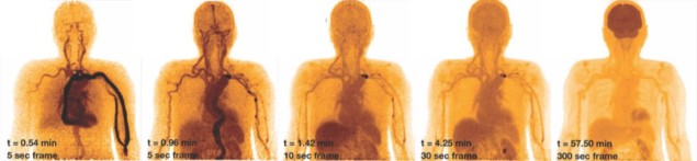 PennPET Explorer acquires first human images – Physics World