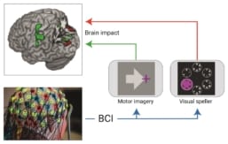 Brain–computer interface could be tailored to treat brain disorders ...